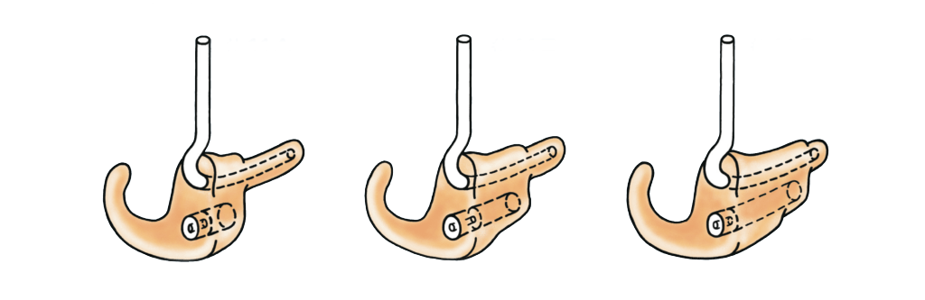 Custom Earmold Manual